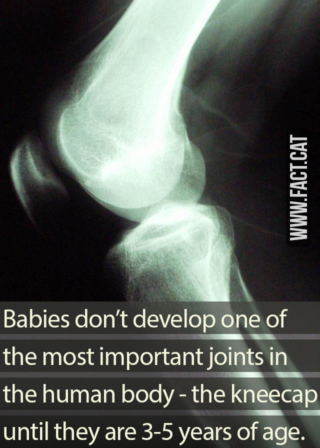  Do Babies Have Kneecaps 